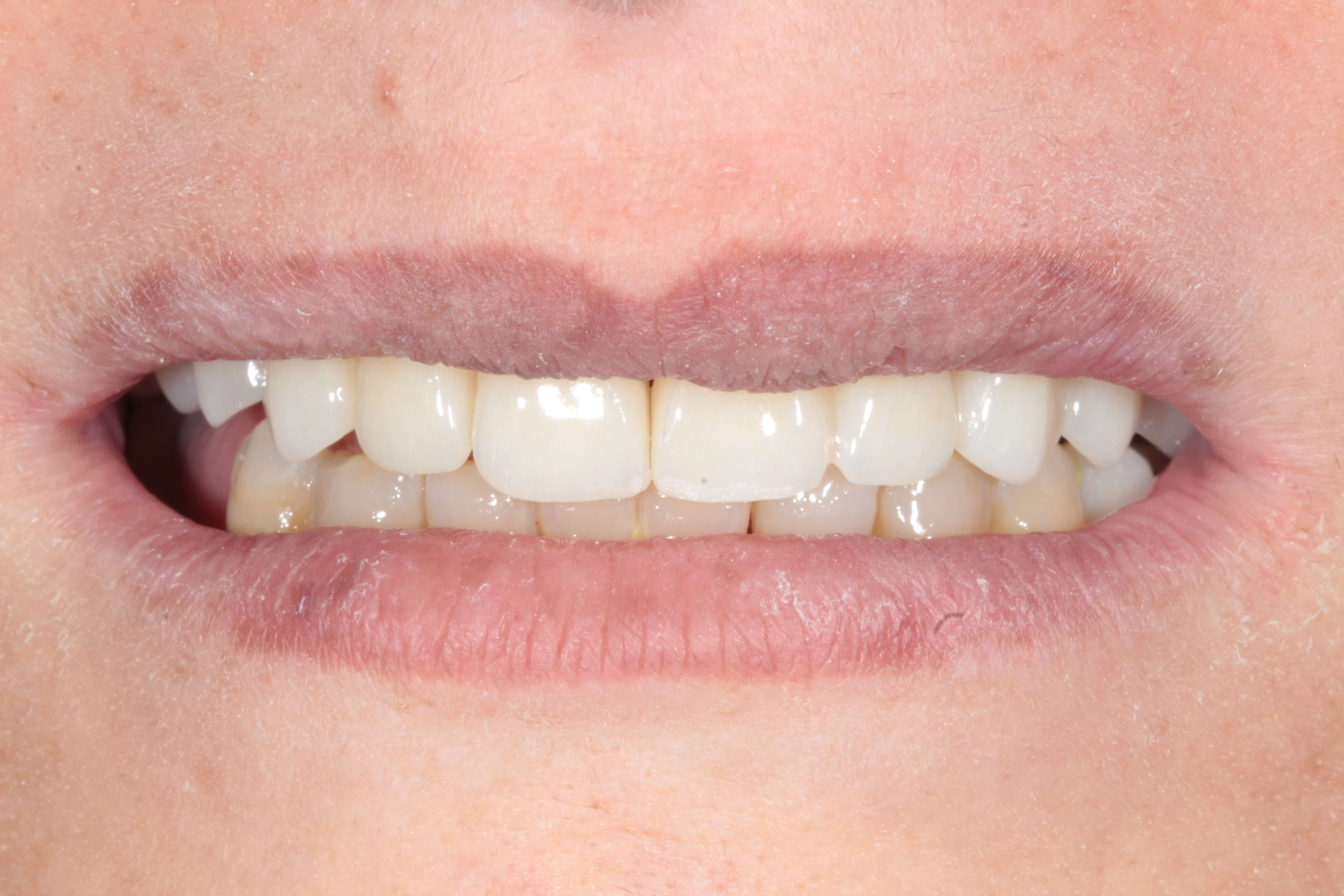 Legends Dental — Premium Cosmetic & Implant Dentistry in Gregory Hills